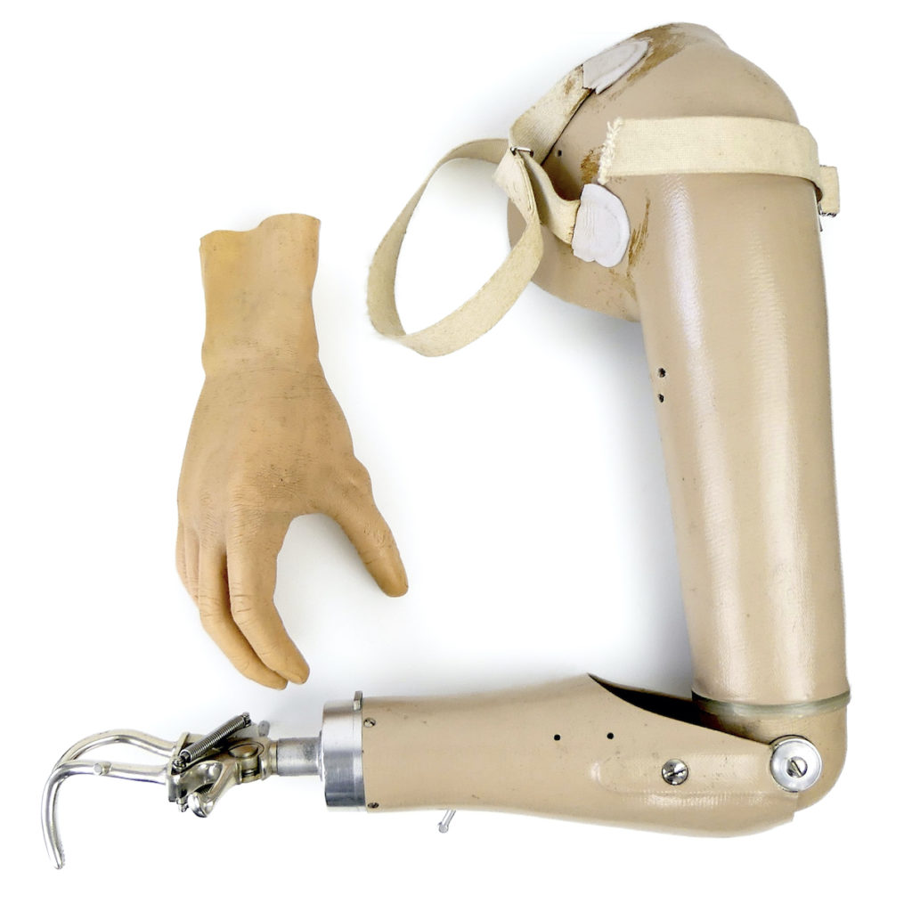 Prothèse de bras vintage avec pince mécanique et main en silicone